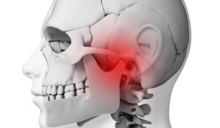 Prevención de la Disfunción de la Articulación Temporomandibular (ATM ...